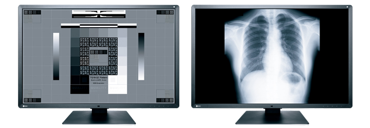 RadiCS UX2 - EIZO Hellas