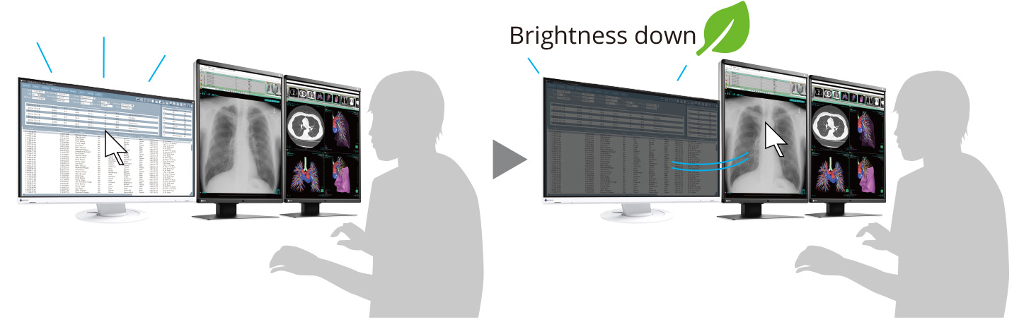 RadiCS UX2 | EIZO Hellas